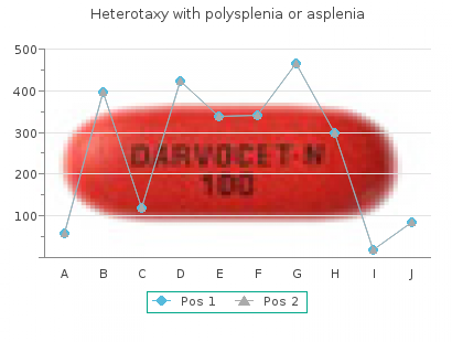 Coreg 3.125 mg, 6.25 mg, 12.5 mg, 25 mg. Cheap Coreg online