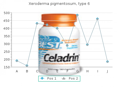 Acular 5 ml. Buy Acular online